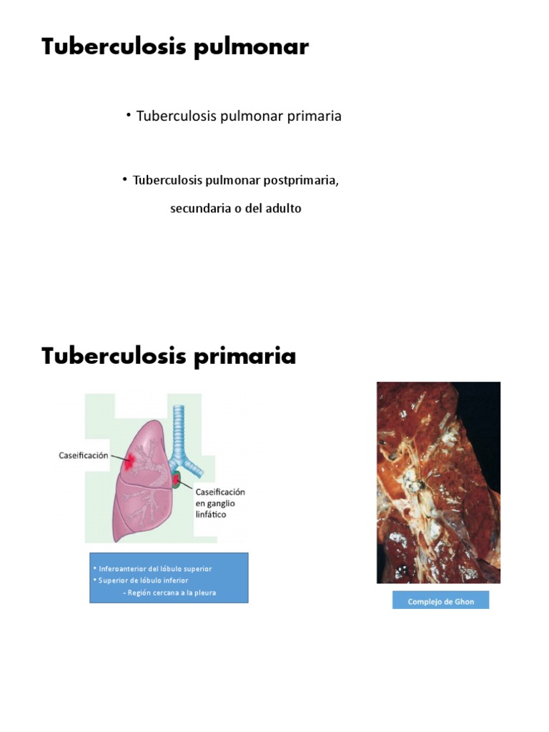 Tuberculosis pulmonar | PDF | Tuberculosis | Tos
