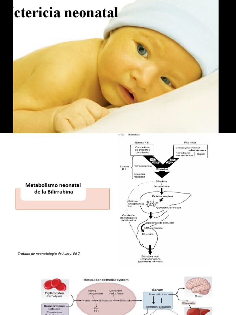 Ictericia Neonatal | PDF | Enfermedades y trastornos | Causas de la muerte