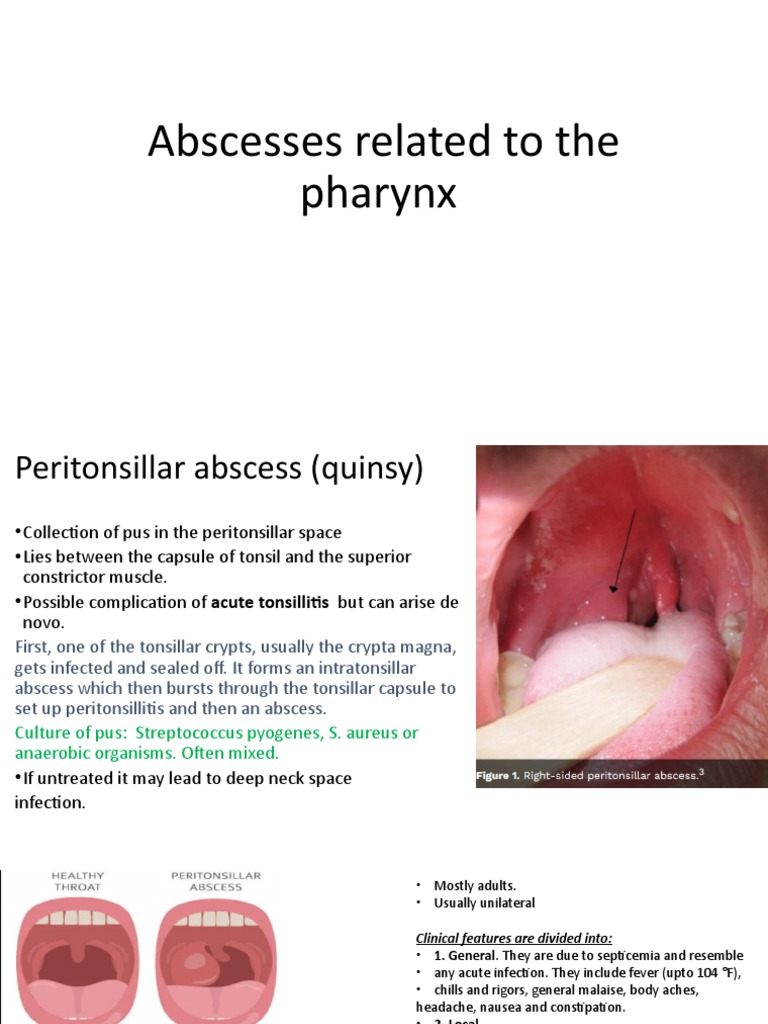 Abscesses Related To The Pharynx | PDF | Common Carotid Artery | Esophagus