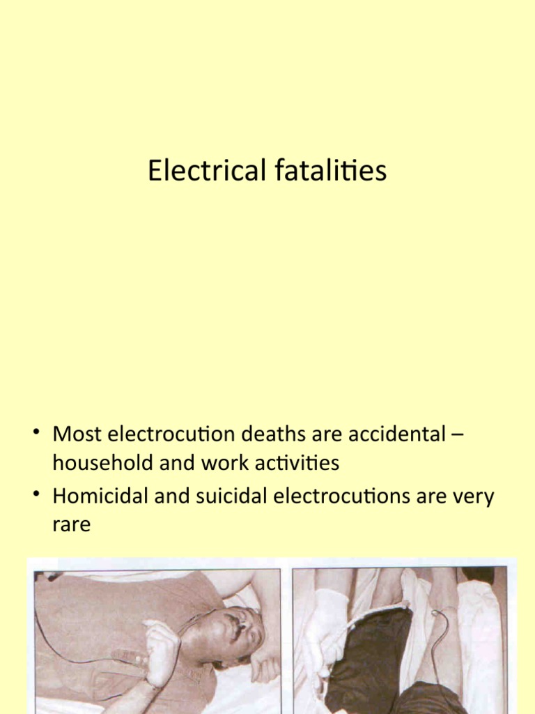 Electrical Fatalities | PDF | Physiology | Clinical Medicine