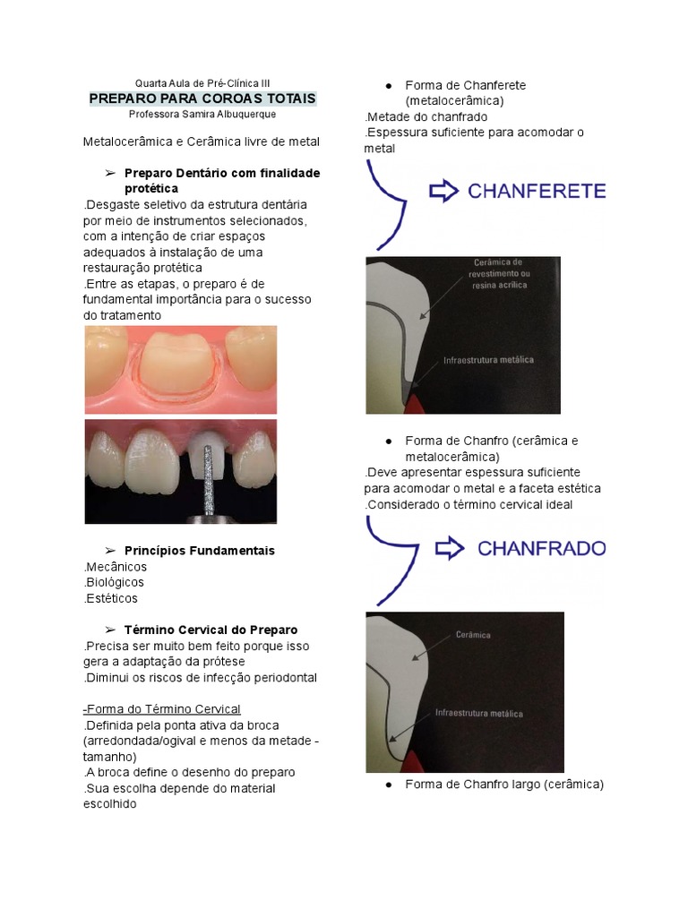 Preparo para Coroas Totais | PDF | Dente