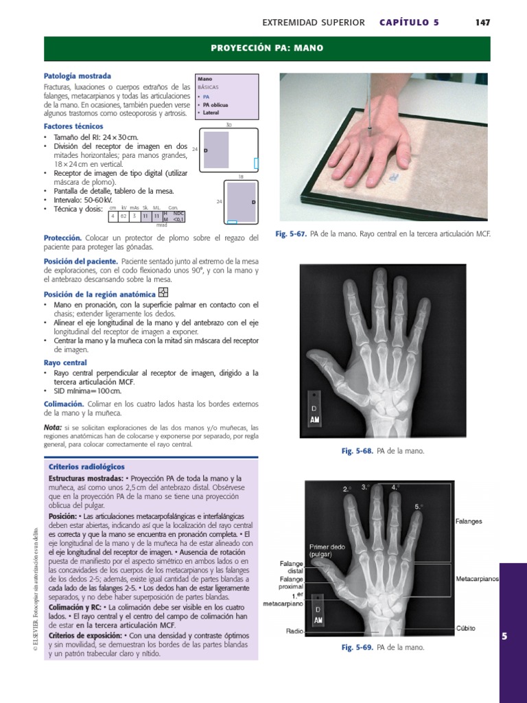 Posicionamiento Basico - Mano y Muñeca | PDF | Mano | Codo