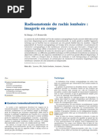 Examen Radiologique du Gril Costal | PDF | Thorax | Système squelettique