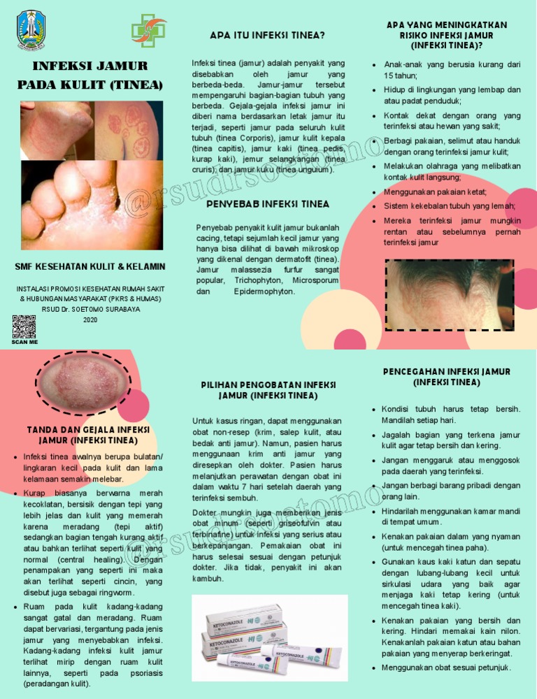 Infeksi Jamur Kulit: Tinea dan Perawatannya | PDF