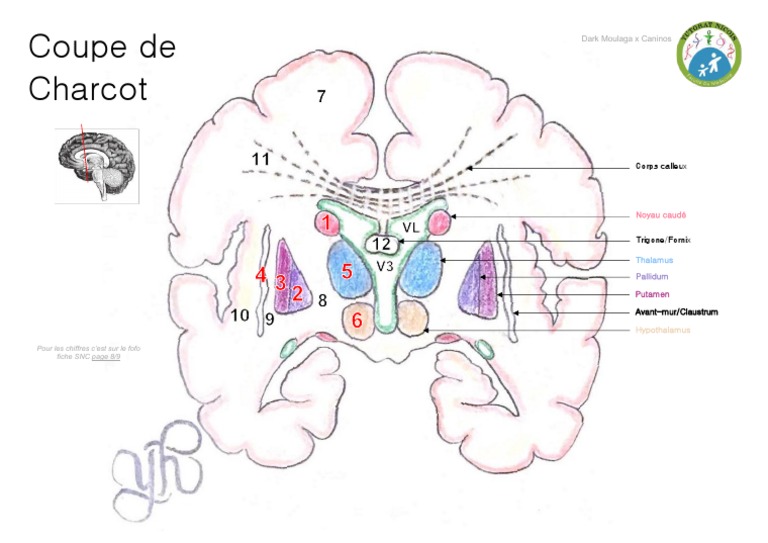 Coupe de Charcot | PDF