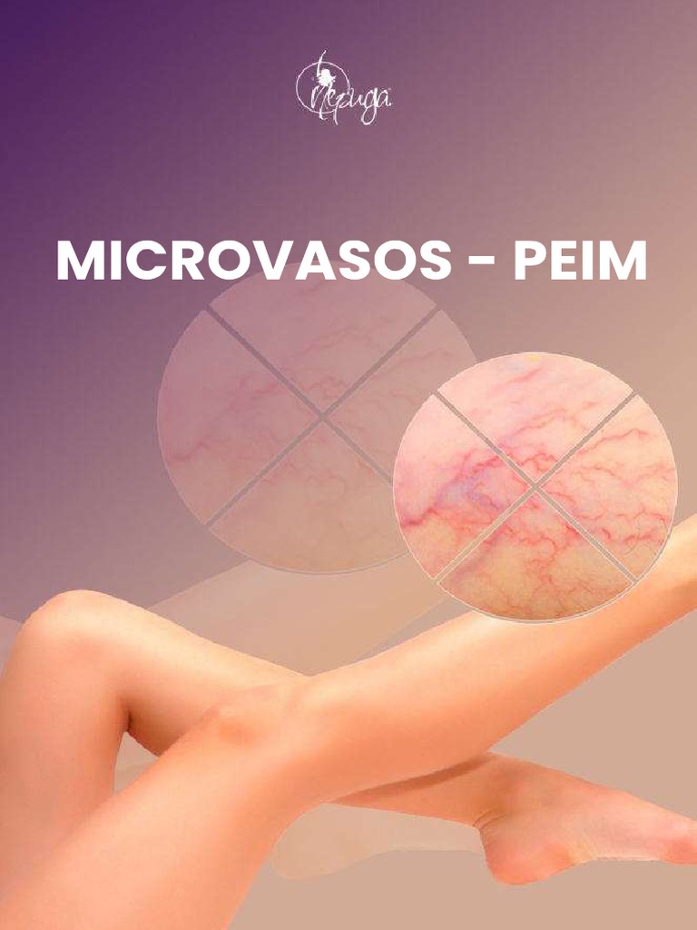 Workbook Microvasos - PEIM | PDF