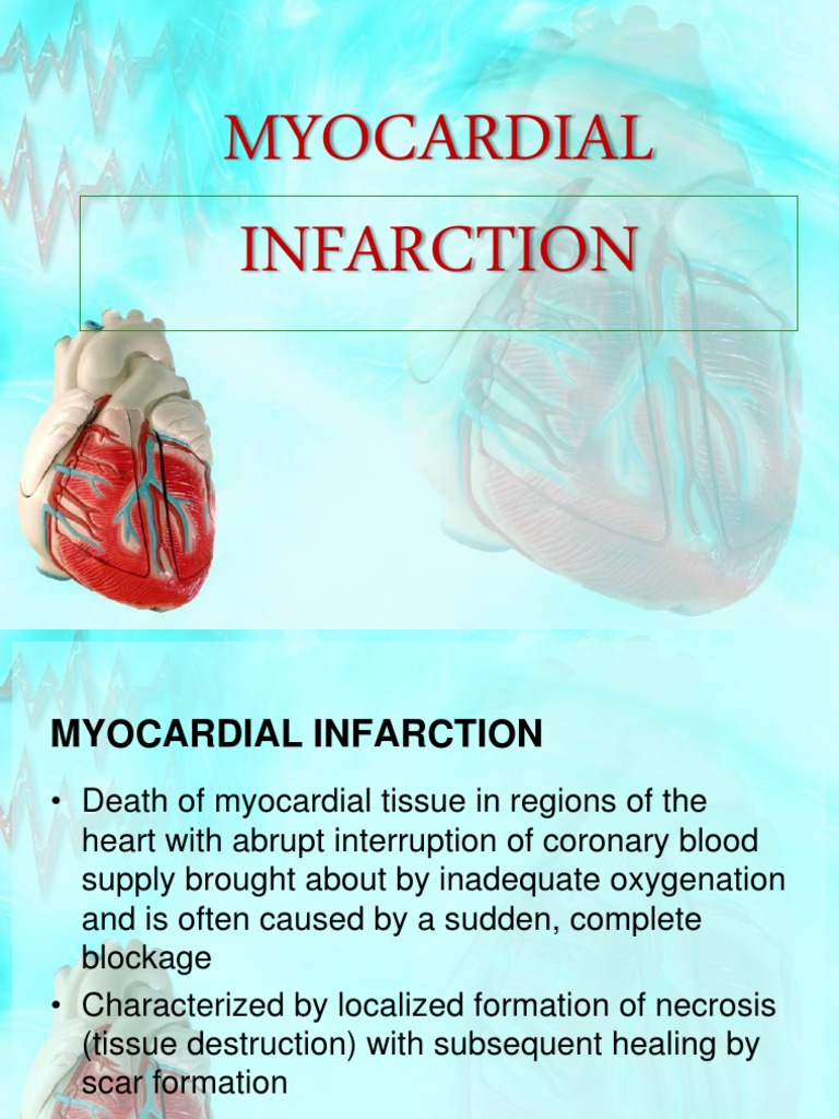 Myocardial Infarction | PDF | Myocardial Infarction | Angina Pectoris