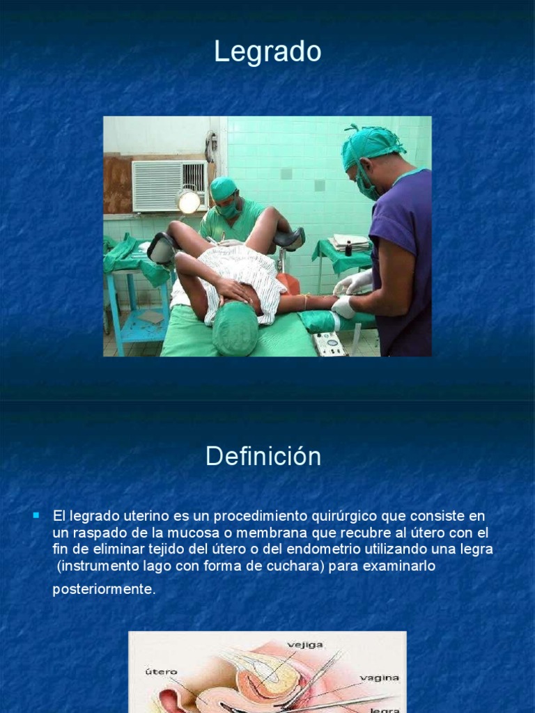 Legrado | PDF | Sistema Reproductor Femenino Mamífero | La salud de la ...