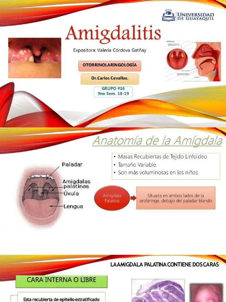 Amigdalitis 111084759 | PDF