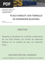 Placa Hawley Con Tornillo de Expansión Bilateral | PDF | Diente | Ortodoncia