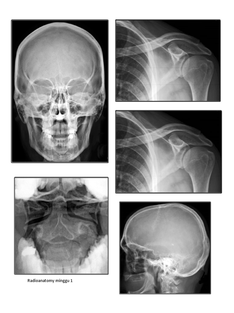 Radioanatomy Minggu 1 | PDF