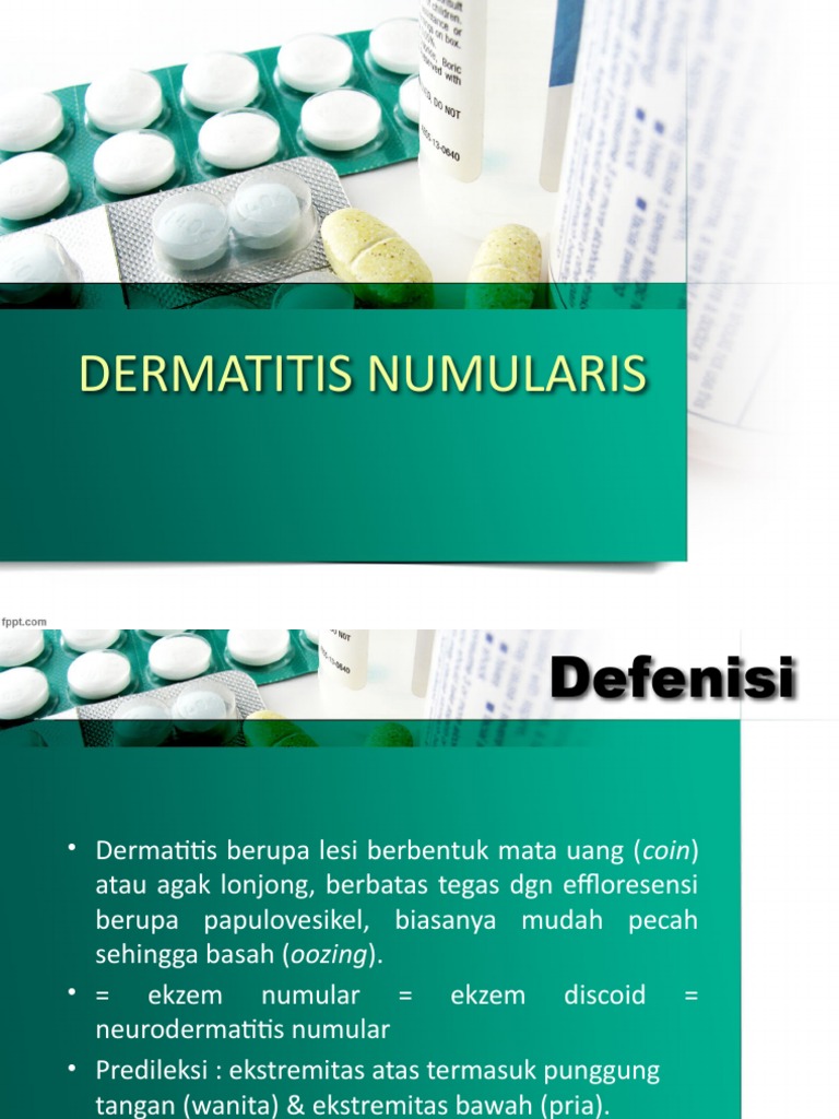 Dermatitis Numularis | PDF | Sains & Matematika