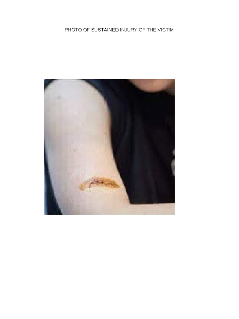 Photo of Sustained Injury of The Victim | PDF