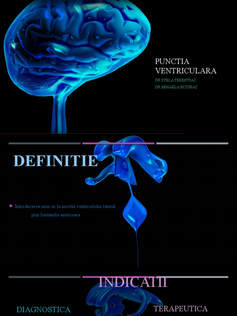 Punctia Ventriculara ST | PDF