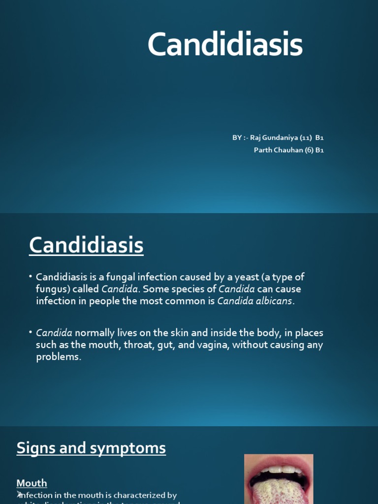 Candidiasis | PDF | Candidiasis | Skin