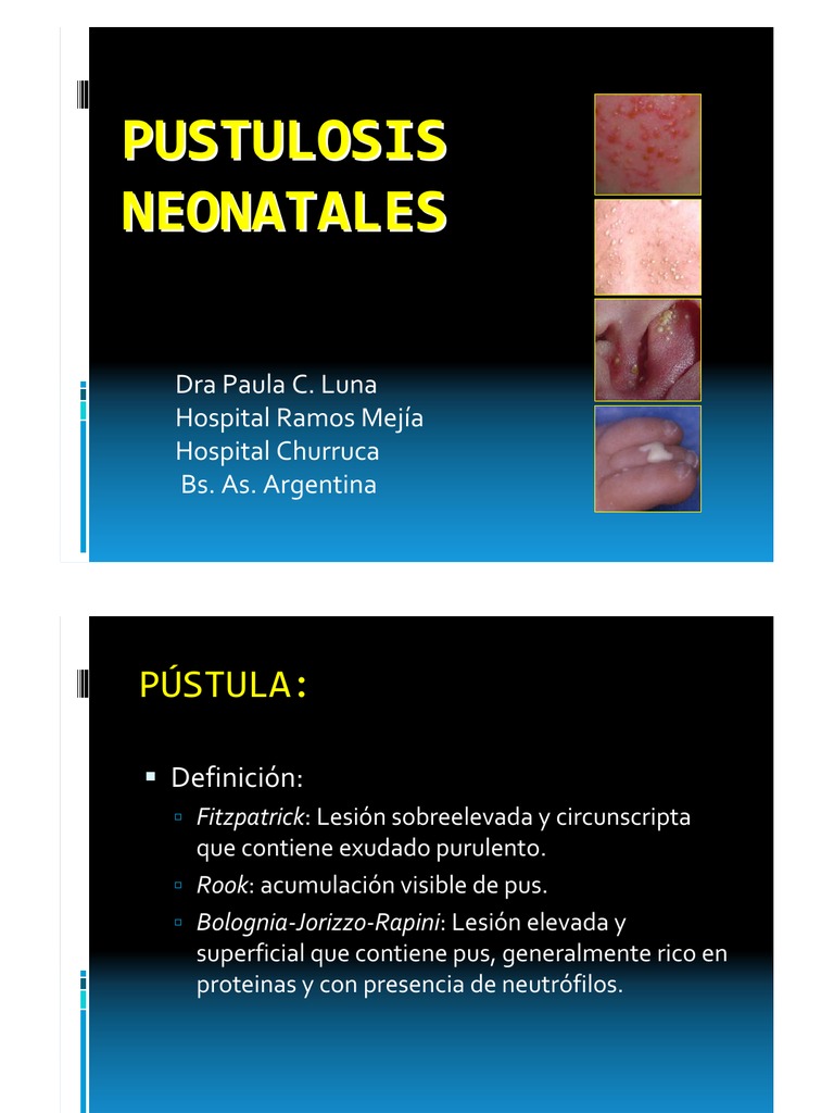Pustulosis_neonatales | Dermatología | Medicina CLINICA