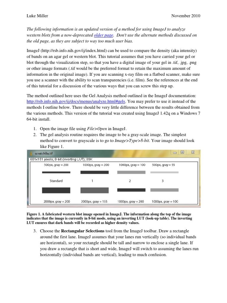ImageJ Gel Analysis | PDF | Western Blot | Image Scanner