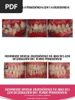 Aparatología Simoes Network en Ortopedia | PDF | Ramas de Odontología ...
