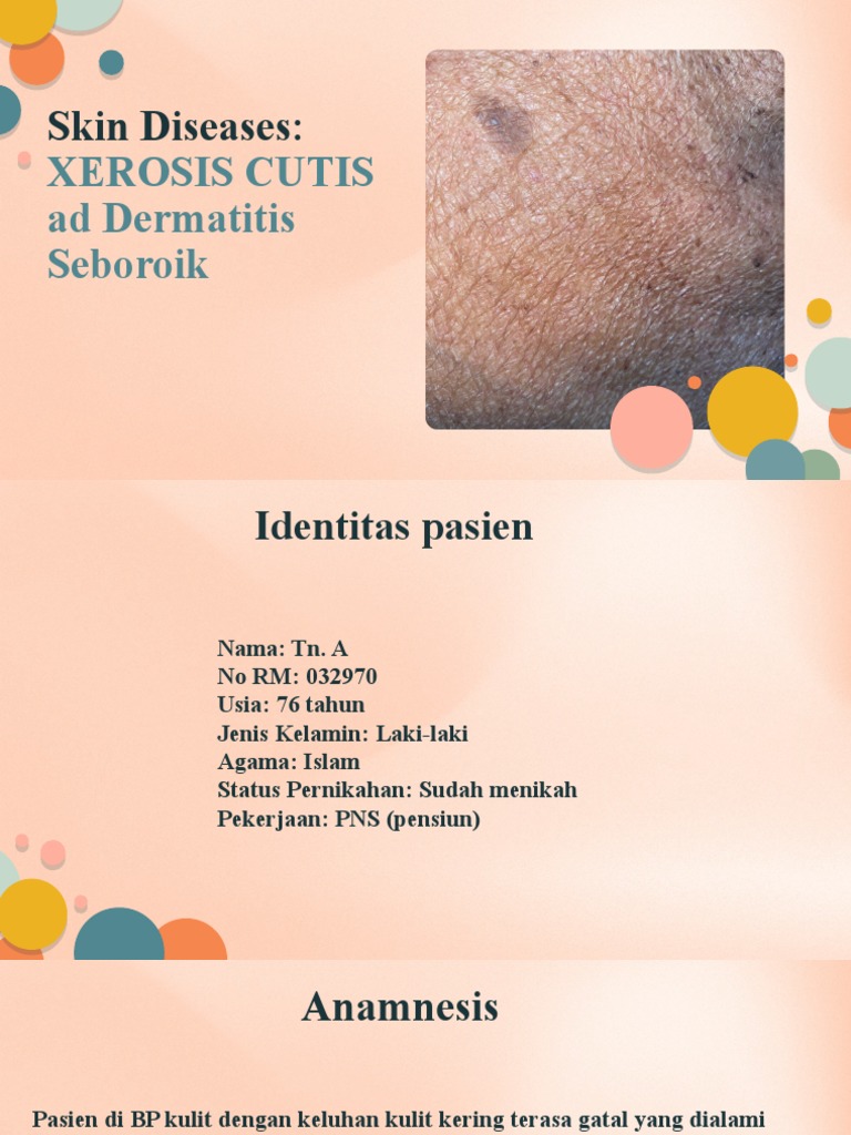 Xerosis Cutis | PDF