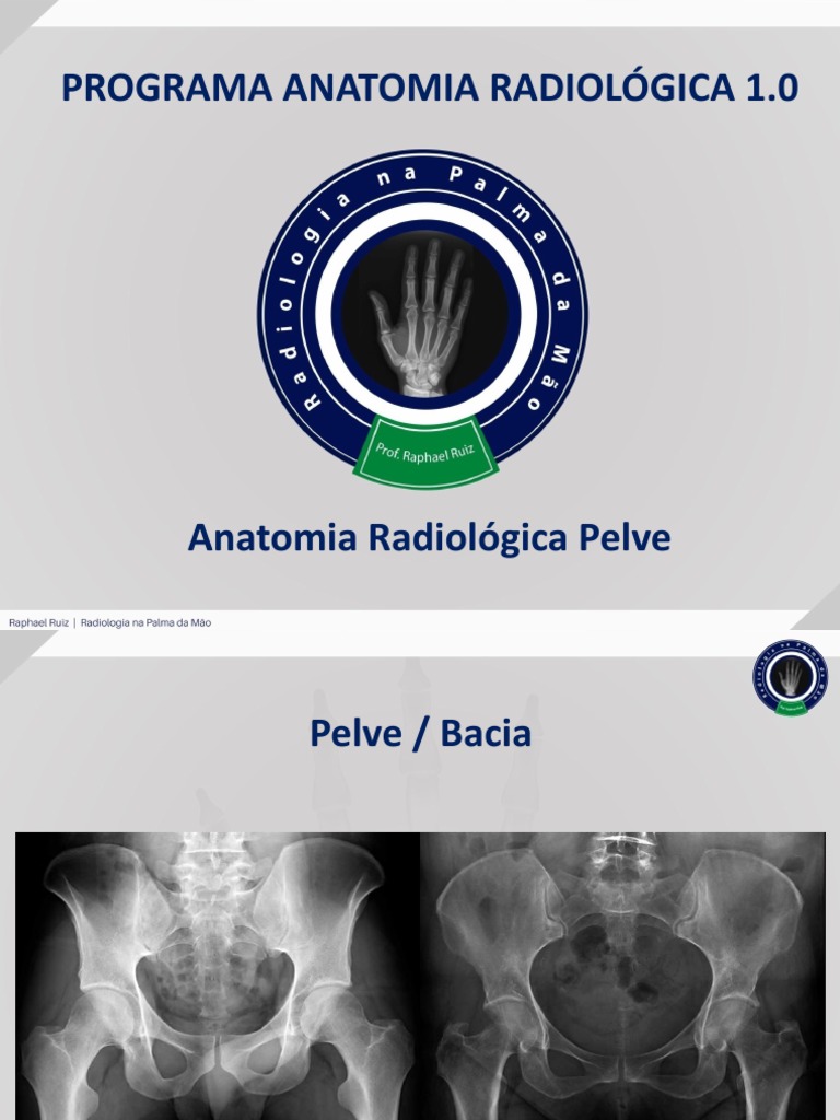 Anatomia Radiológica da Pelve | PDF