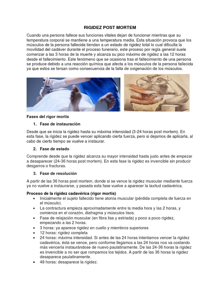 Rigidez Post Mortem | PDF