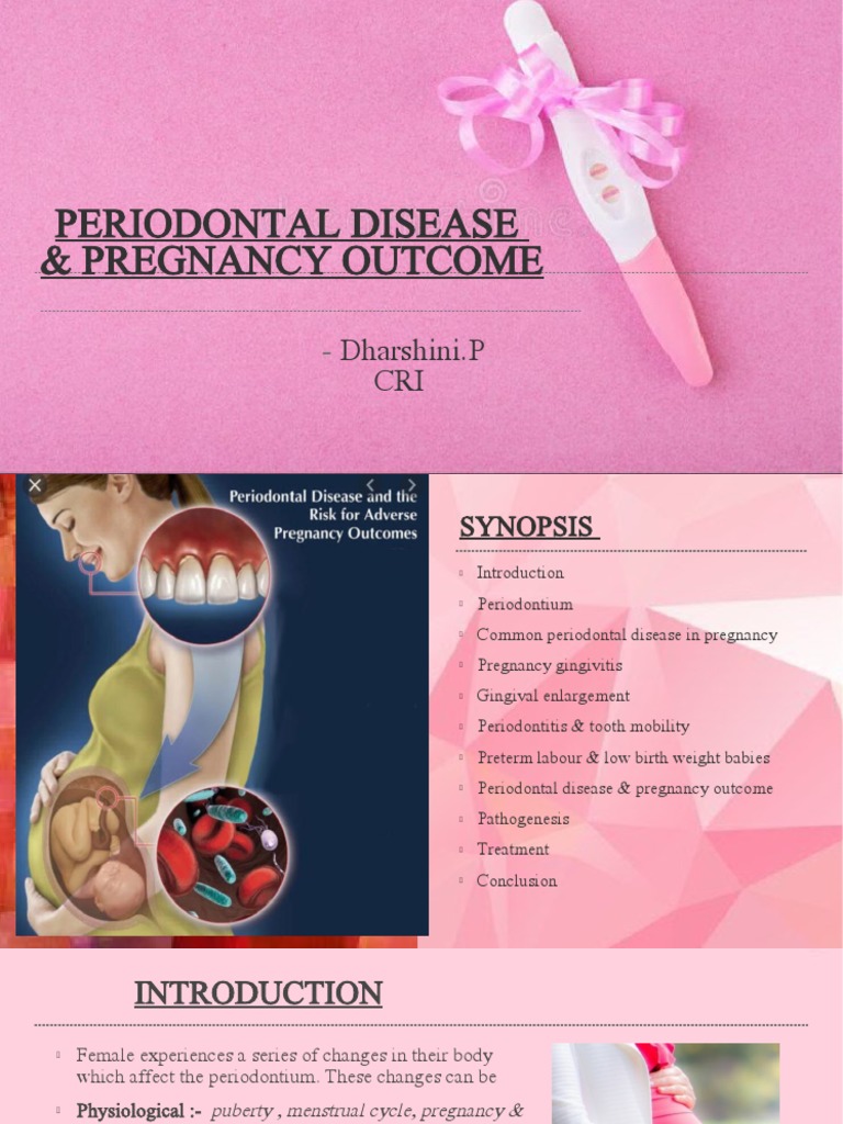 Periodontal Disease and Pregnancy Outcome | PDF | Pregnancy | Preterm Birth