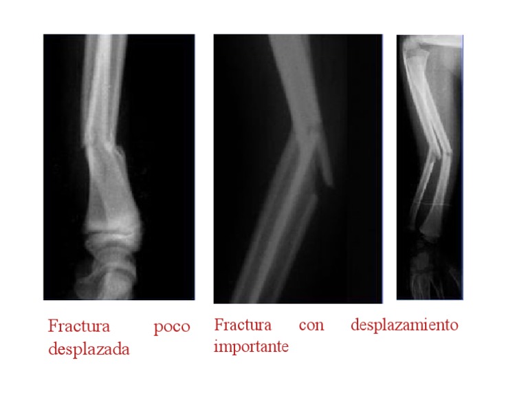 Fx en tallo verde (imágenes) | PDF