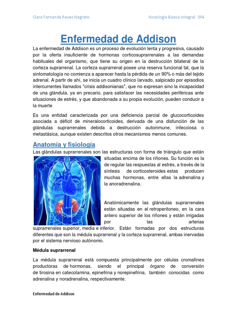 Enfermedad de Addison | PDF | Glándula suprarrenal | Glucocorticoides