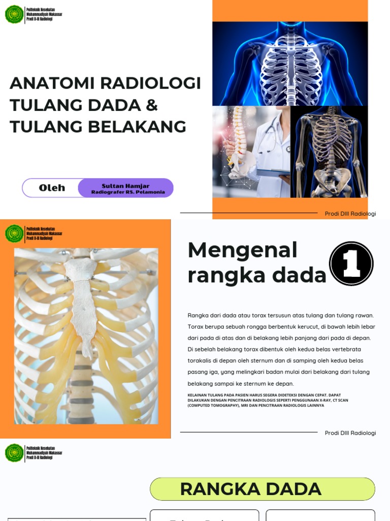 Anatomi Radiologi Tulang Dada & Tulang Belakang: Thynk Unlimited | PDF ...