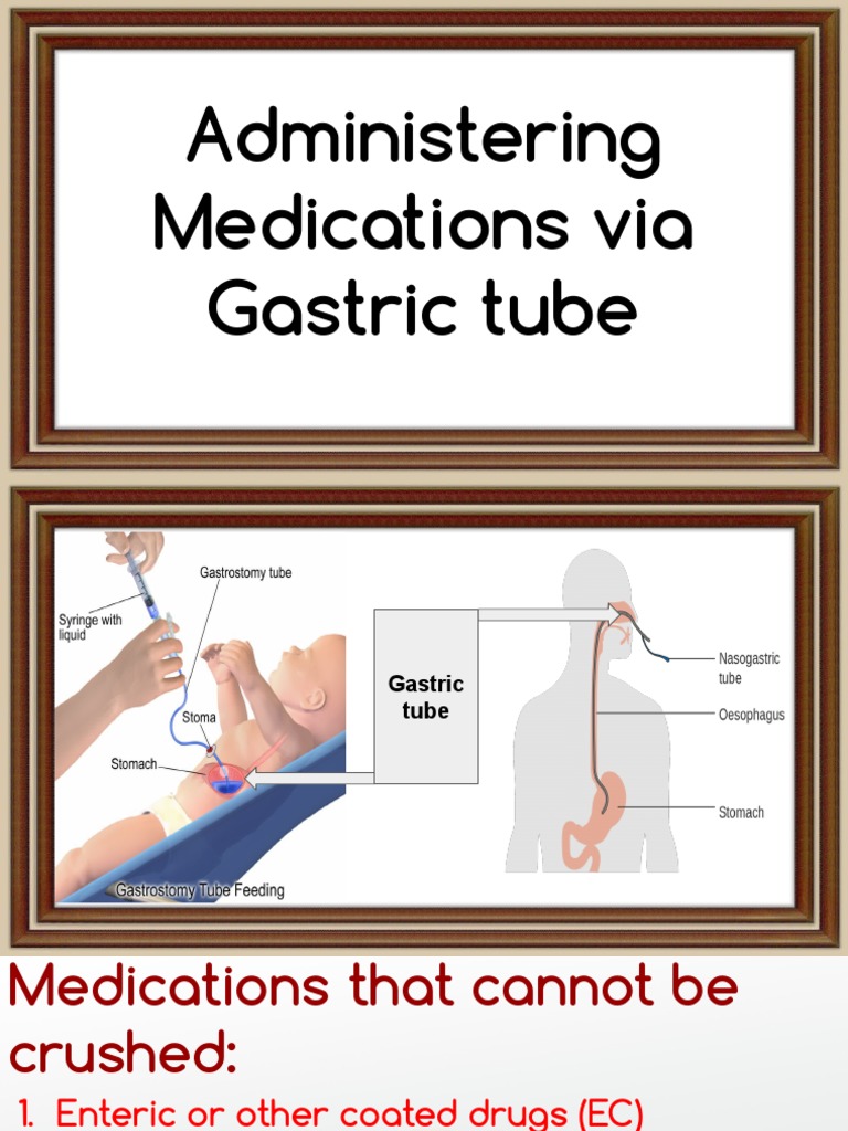 Administering Medication Via Gastric Tube | PDF | Pharmaceutical ...