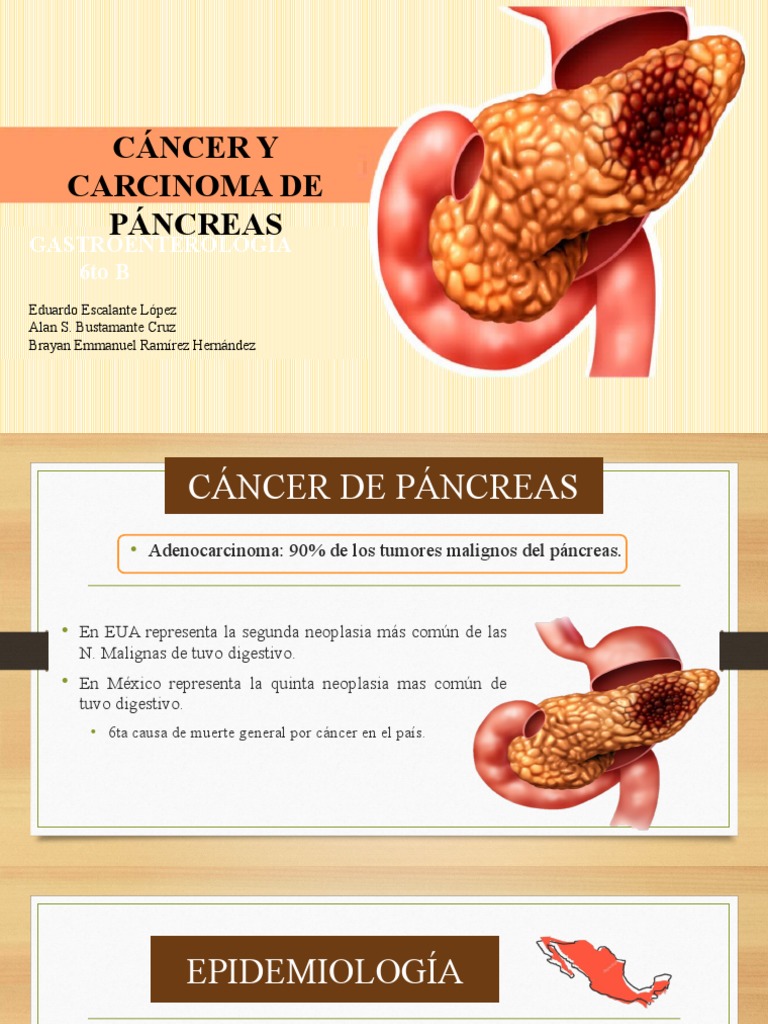 Cáncer de Páncreas y Carcinoma | PDF | Cáncer de páncreas | Cáncer