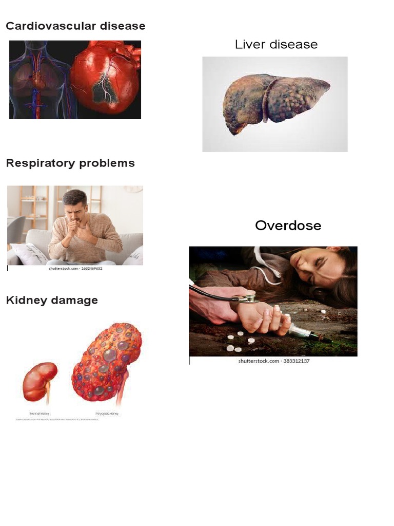 Effects of Drug Abuse | PDF