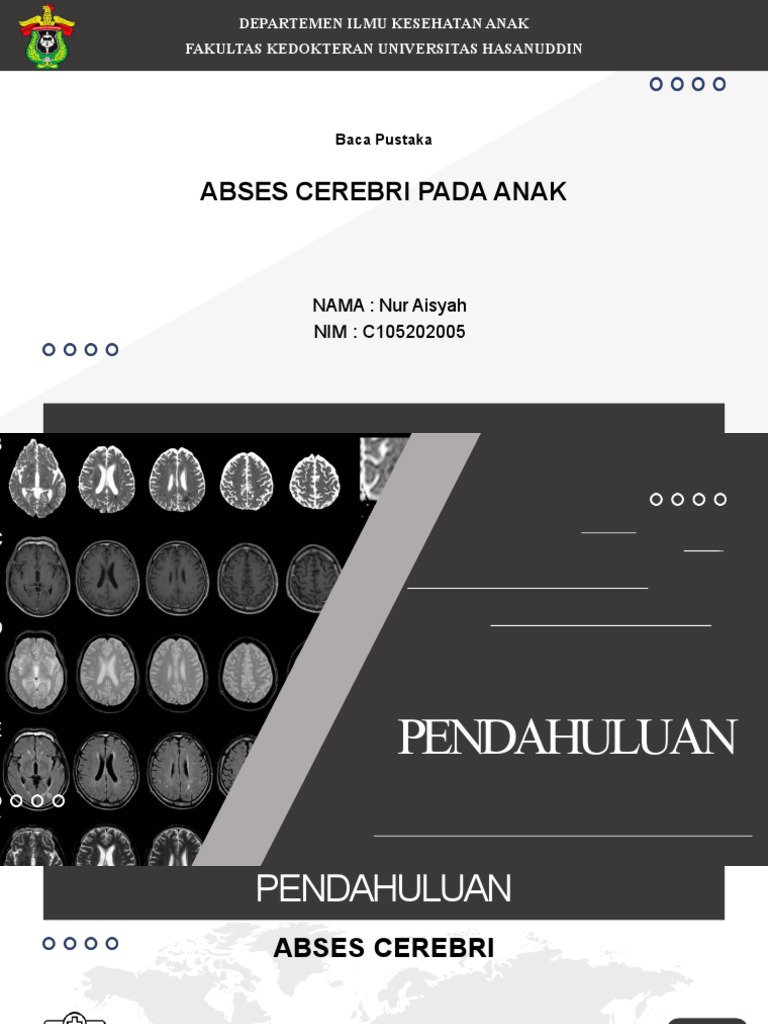 Abses Cerebri pada Anak: Epidemiologi dan Tatalaksana | PDF ...