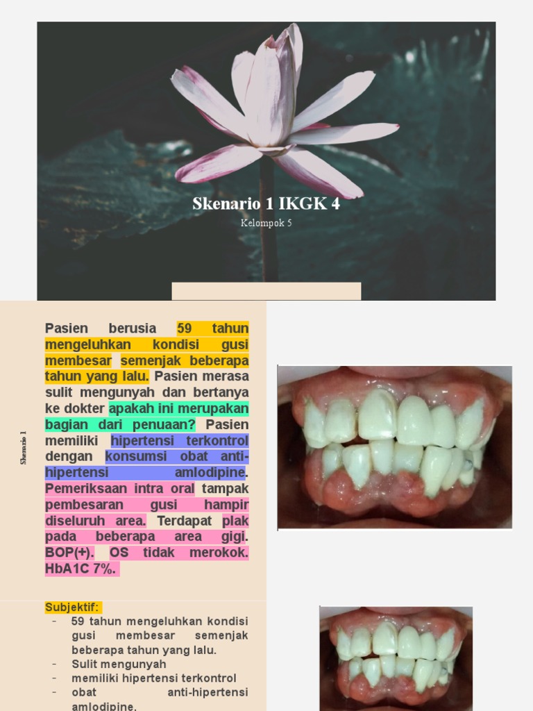 Skenario 1 - Ikgk 4 - Kelompok 5 | PDF | Kesehatan Holistik | Sains & Matematika