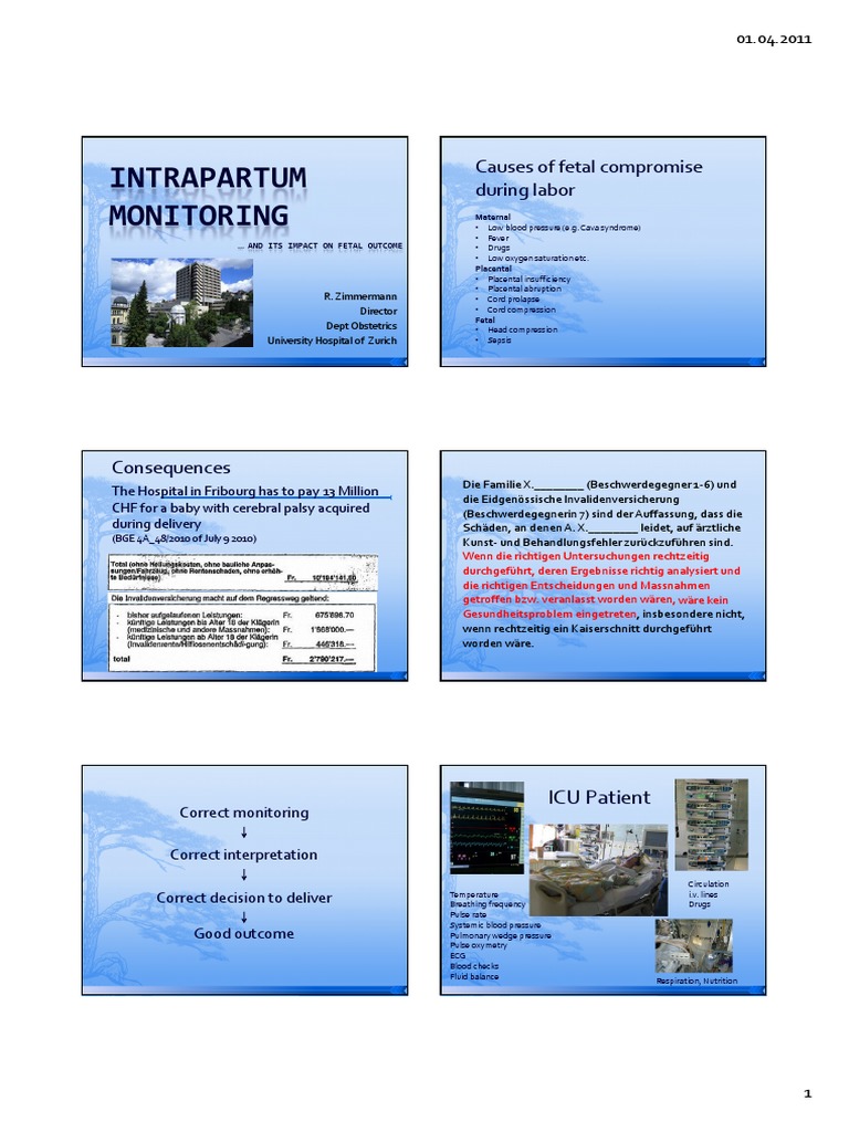Intrapartum Monitoring: Causes of Fetal Compromise During Labor | PDF | Health Sciences ...