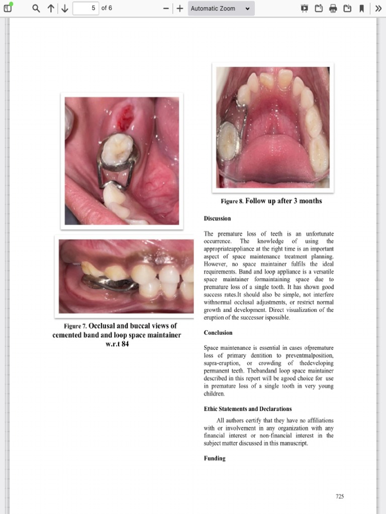 View of Band and Loop A Case Report | PDF | Dentistry Branches | Dental Anatomy