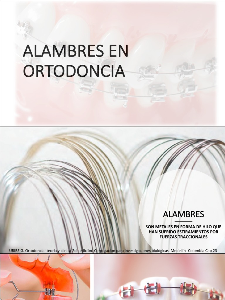 Alambres en Ortodoncia | PDF | Deformación (ingeniería) | Titanio