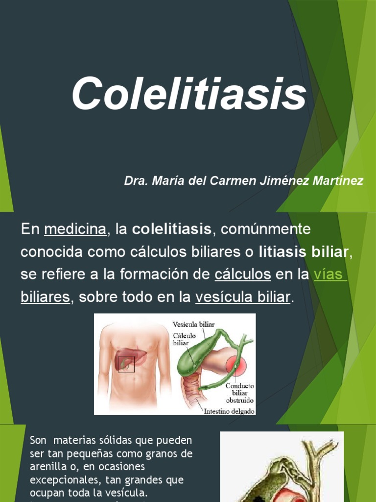 Causas y Tratamiento de Colelitiasis | PDF | Epidemiología | Enfermedades y trastornos
