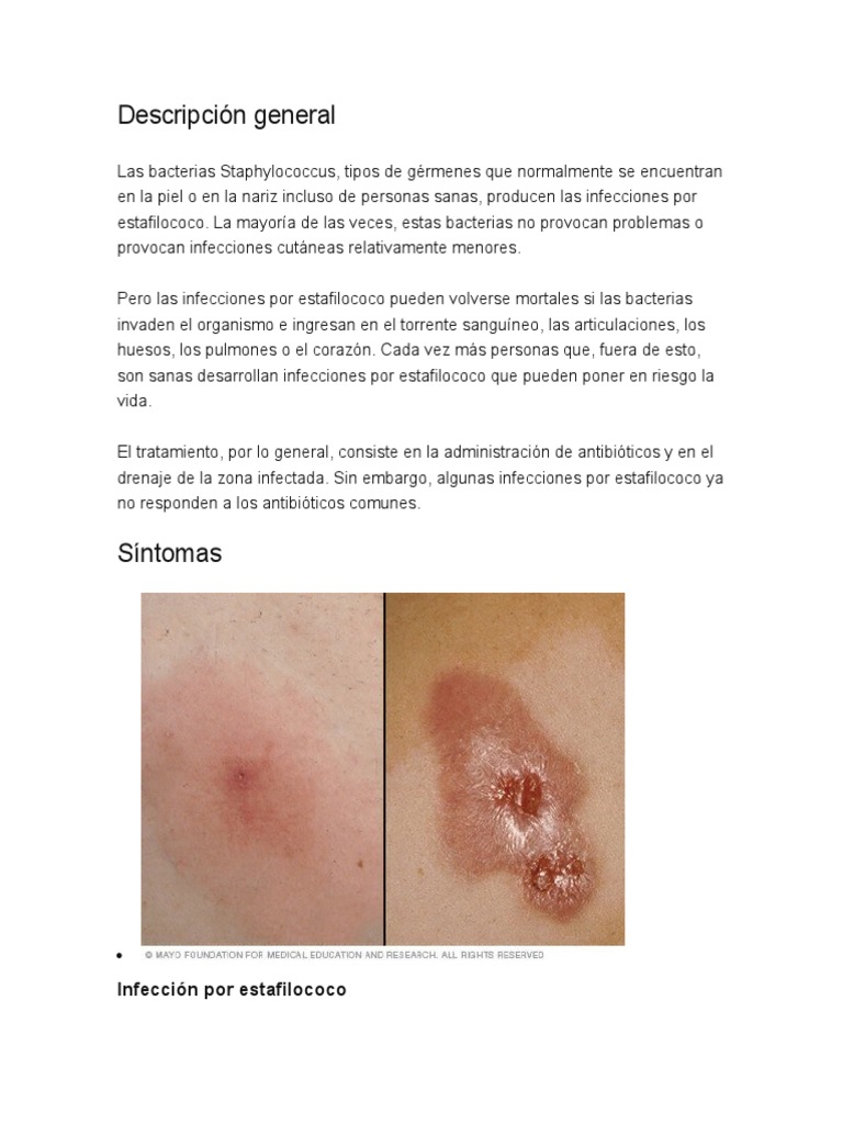 Infecciones por Estafilococos en la Piel | PDF | Staphylococcus Aureus ...