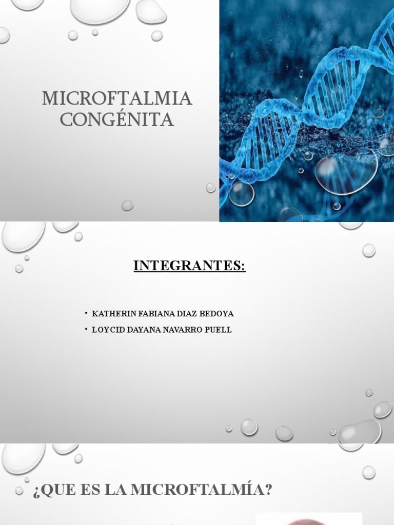 Microftalmia Congénita | PDF | Salud y bienestar
