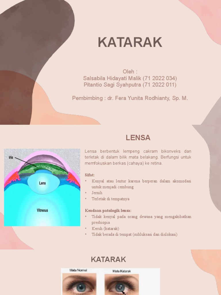 Katarak 1 | PDF