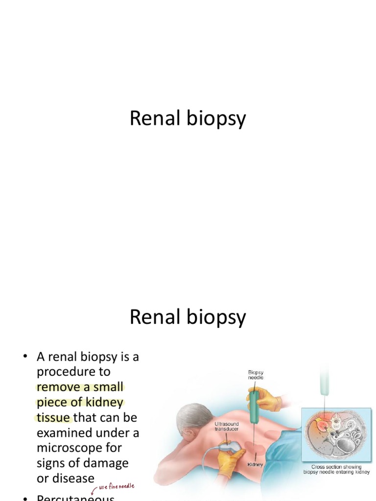 Renal Biopsy | PDF | Kidney | Transplant Rejection