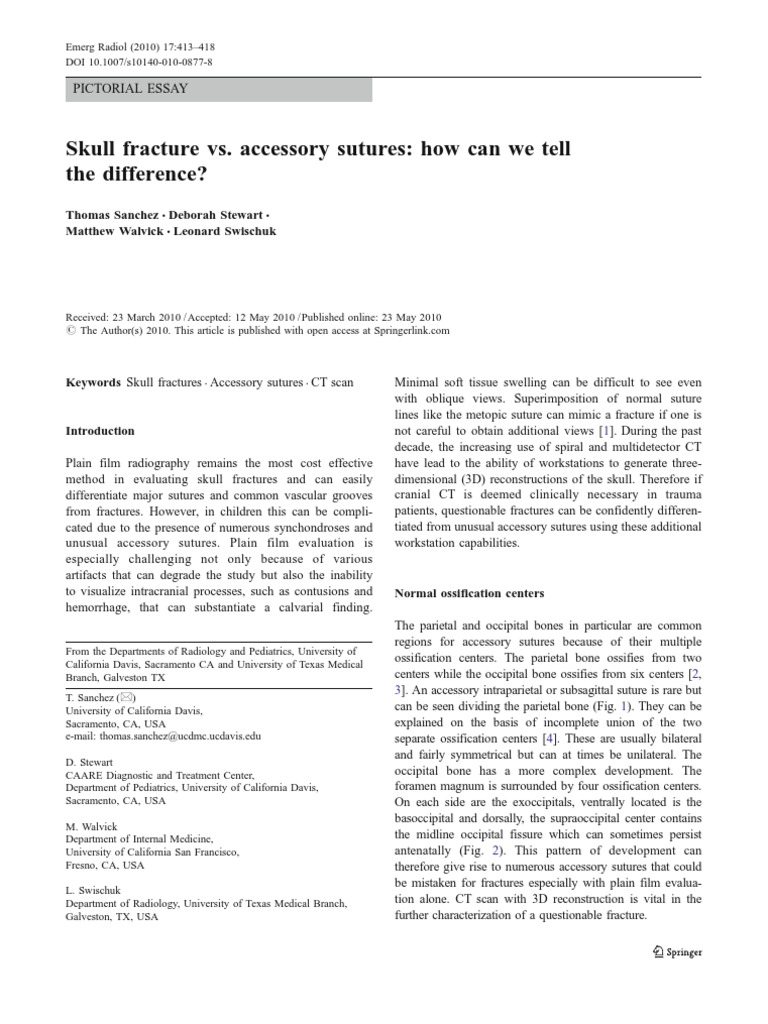 Differentiating Skull Fractures from Accessory Sutures: Characteristics ...
