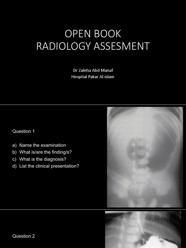 Open Book Radiology Assesment: DR Zaleha Abd Manaf Hospital Pakar Al ...