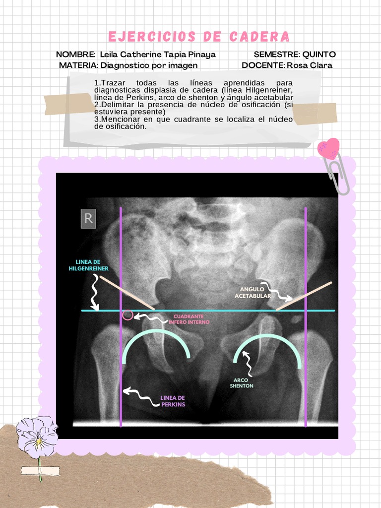 _EJERCICIOS DEDIAGNSTICO POR IMAGEN- CADERA | PDF