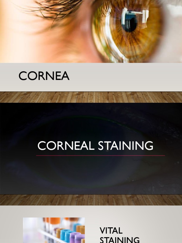 Cornea | PDF | Cornea | Human Eye