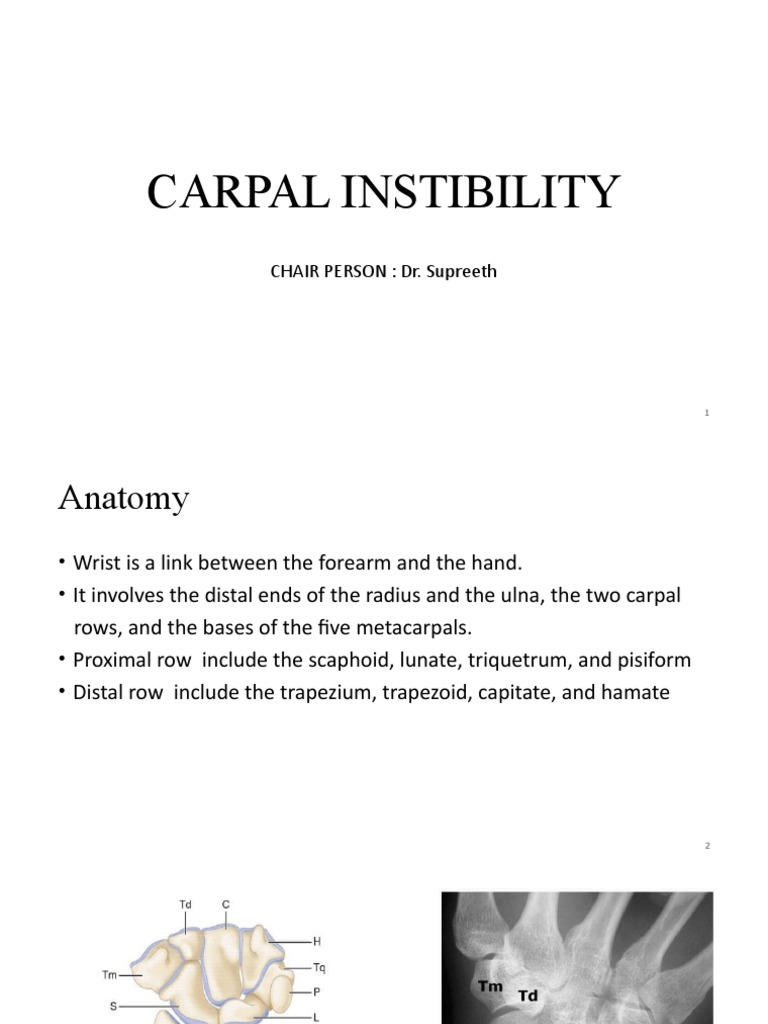 Carpal Instability Overview | PDF