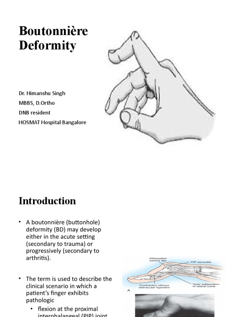 Boutonnière Deformity: Dr. Himanshu Singh MBBS, D.Ortho DNB Resident ...