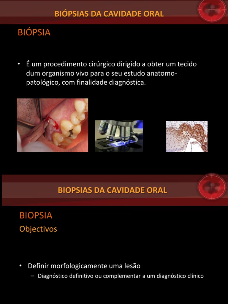 Biópsia: Biópsias Da Cavidade Oral | PDF | Biópsia | Patologia