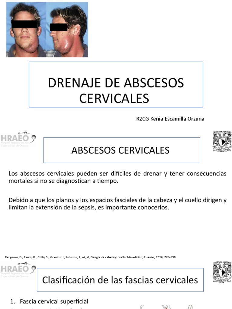 Drenaje de Abscesos Cervicales | PDF | Cabeza y cuello humanos ...